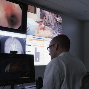 LBE Webinar Insights into Evaluating Donor Lung Suitability for EVLP ...